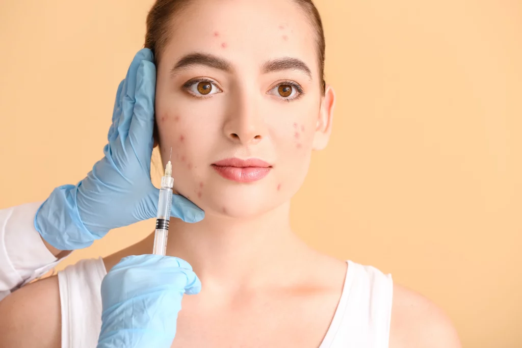 Acne Injection By Steroid in Broomfield, CO