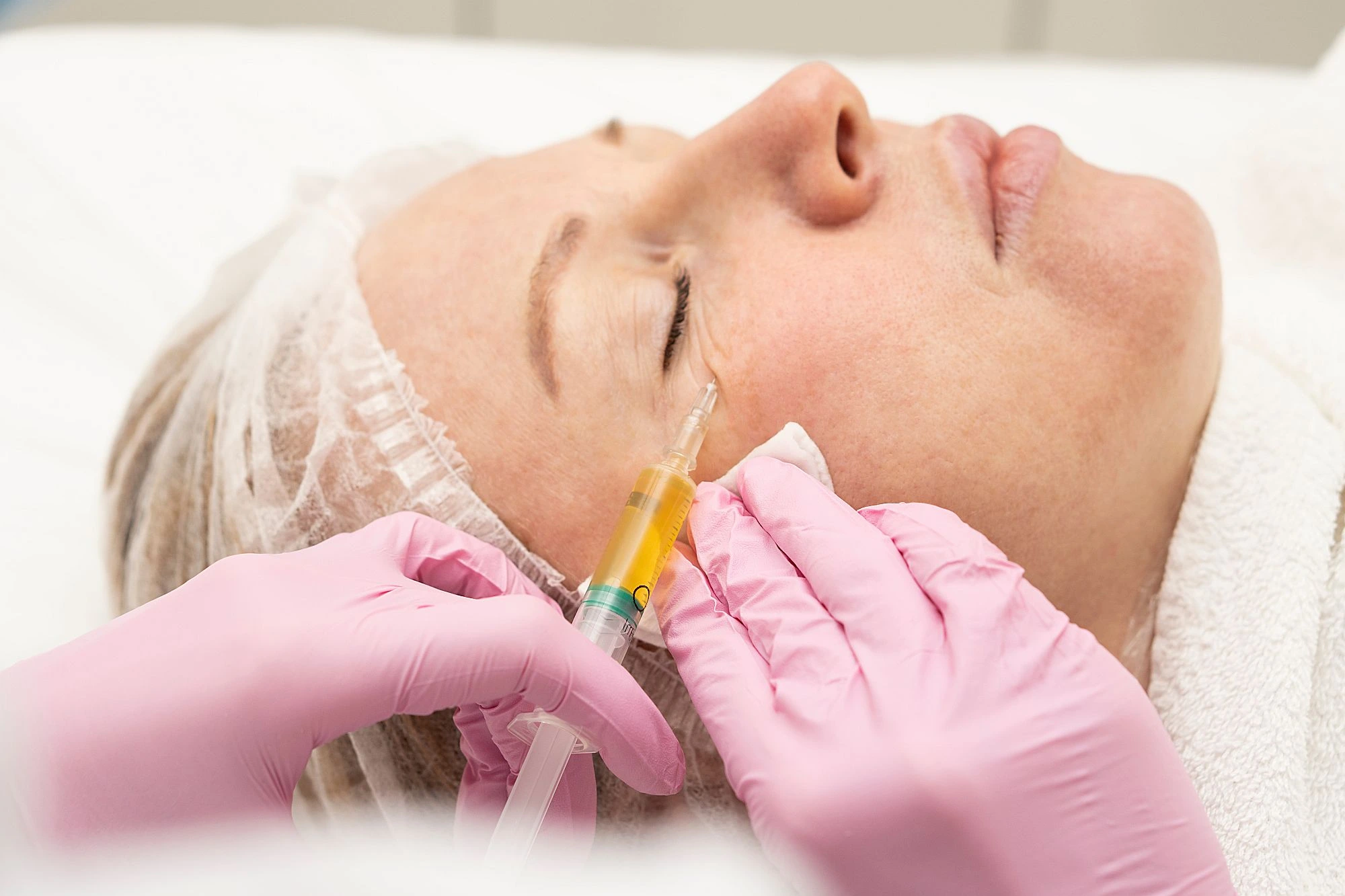 PRP Skin rejuvenation in Broomfield, CO | The Natural Place